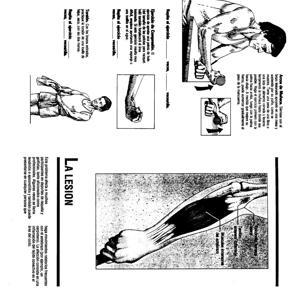 Ejercicios para epitrocleitis - Ortopédica - Ortopedistas de alta ...
